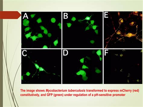 Gfp Application In Bacterial Dynamics And Disease Diagnosis Pptx