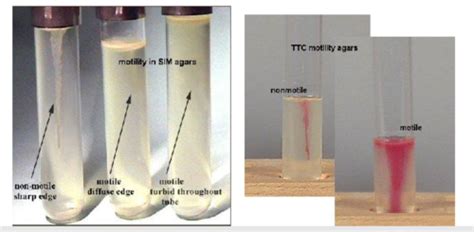 Enterobacter Aerogenes Motility Test