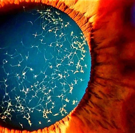 I Have Actual Stars In My Eye Epicapsular Stars R Mildlyinteresting