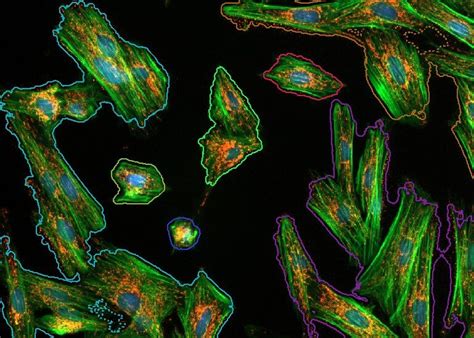 Ai Deep Learning Image Pro Media Cybernetics