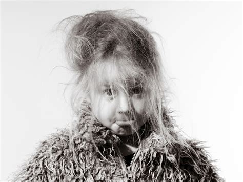 The cause of uncombable hair syndrome identified | Newsroom | Inserm
