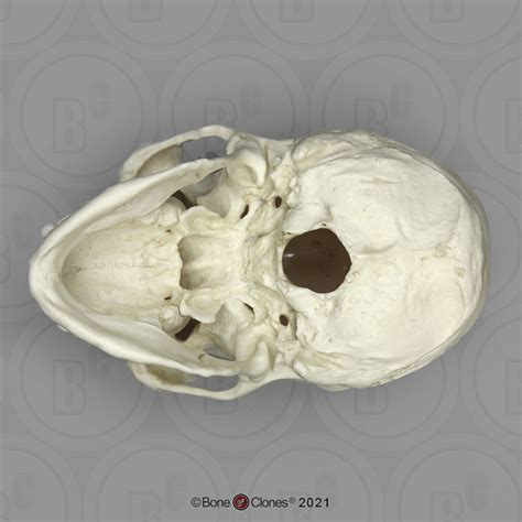 Human Male Australian Aboriginal Skull Bone Clones Osteological