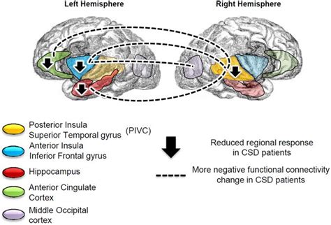 Anterior Cingulate