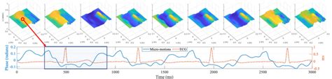 Radar Measurements Of Body Surface Motion Induced By The Cardiac Download Scientific Diagram