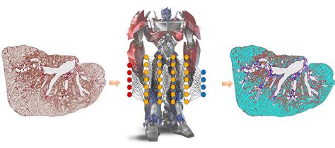 Transformers For Semantic Segmentation By Nitin Singhal Medium