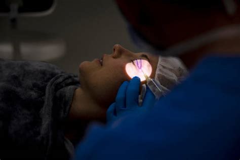 A Modified Levator Resection Ophthalmology Advisor