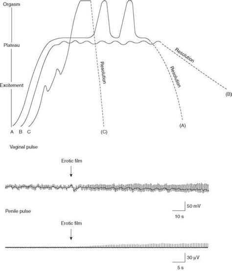 Ejaculatory Anomalies Reproductive Pathology Atlas Of Clinical Andrology