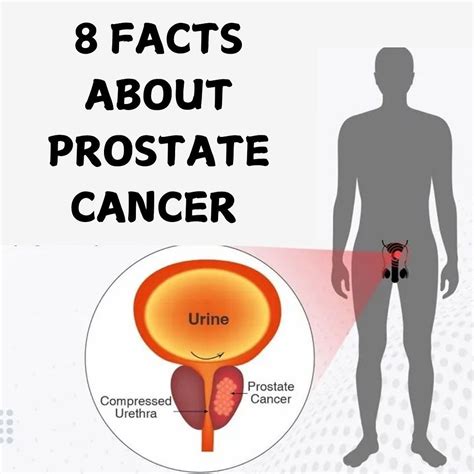 Understanding Prostate Cancer 8 Facts Every Man Should Know