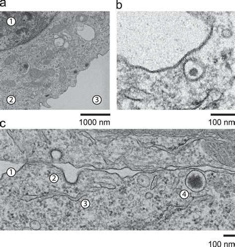 Thin Section Transmission Electron Micrographs Of Cells A Cultured Download Scientific