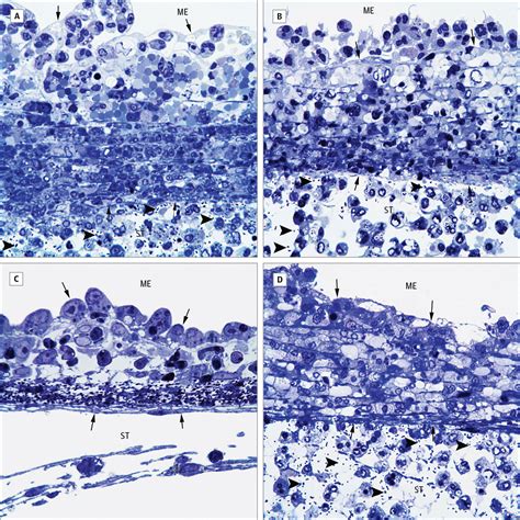 Viability And Virulence Of Pneumolysin Pneumococcal Surface Protein A