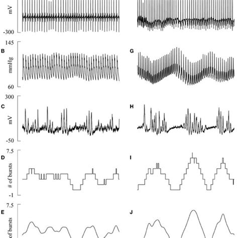 The Line Plots Show Examples Of Ecg Invasive Ap Integrated Msna Download Scientific Diagram