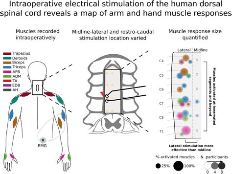 Spinal Map