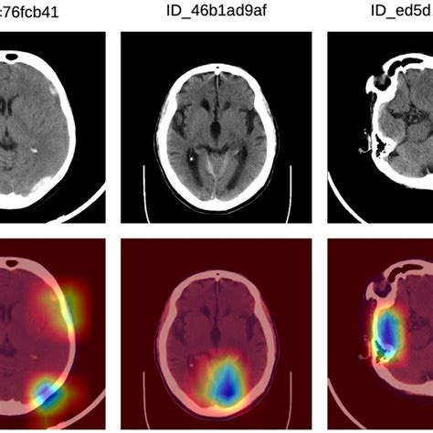 Preprocessing Flow Of A Single Ct Slice In Dicom Format Each Dicom