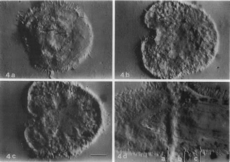 Serial Cross Sections In The Region Of The Abscission Layer And