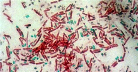 Bacillus Cereus Endospore Stain Paulamcywalls