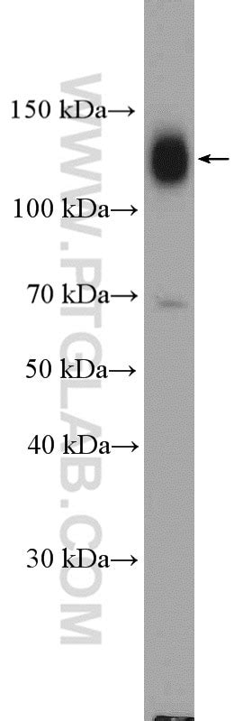 Integrin Beta 1cd29 Antibody 26918 1 Ap Proteintech