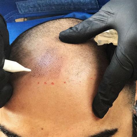 Micropigmentation Course Microblading Academy Inc