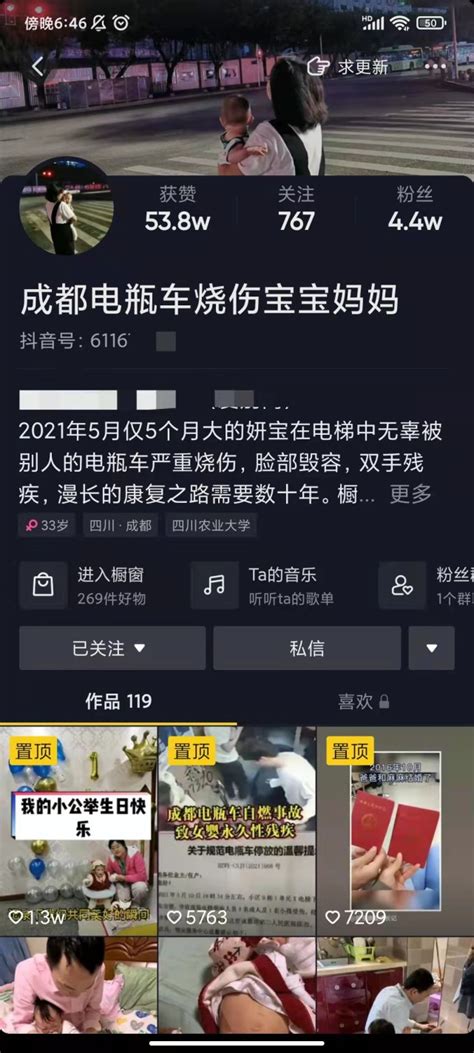 追踪｜成都电瓶车自燃被烧伤的5月龄女婴：双手致残 已接受5次全麻植皮手术腾讯新闻