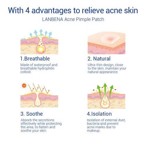 Lanbena Pimple Patch Acne Treatment Patch Acne Stickers Blemish Pimple ...
