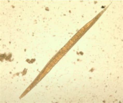 What Are Helminths Microscope Clarity