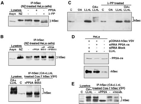 Specific Phosphorylated Forms Of Hsecurin Which Are Degraded By The