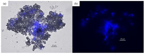 Microorganisms Free Full Text Novel Methanobacterium Strain Induces Severe Corrosion By