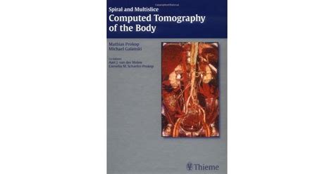 Spiral And Multislice Computed Tomography Of The Body By Mathias Prokop