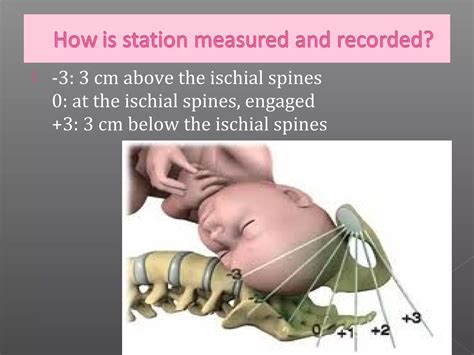 Mcq On Normal And Abnormal Labor For Undergraduate Ppt Pregnancy
