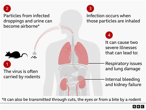 What Is Hantavirus And How Does It Spread Bbc News