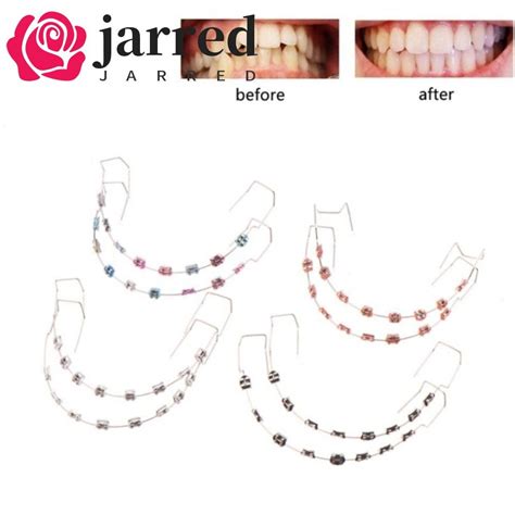 Jarred 1 Pair Temporary Tooth Decoration Colorful With Metal Wires