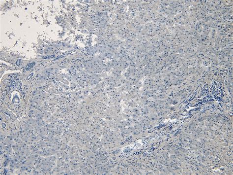 Cpt1a Antibody Nb100 53791 By Novus Part Of Bio Techne