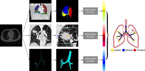 Frontiers Imaging Based Deep Graph Neural Networks For Survival Analysis In Early Stage Lung