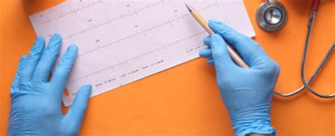How To Perform Ecg Categorization And Detect Arrhythmia Knime