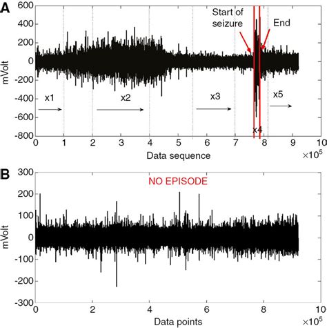 tsallis q triplet of two eeg time series concerning epileptic and