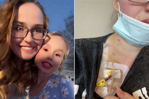 Mama June S Daughter Anna Chickadee Cardwell Begins Chemotherapy For