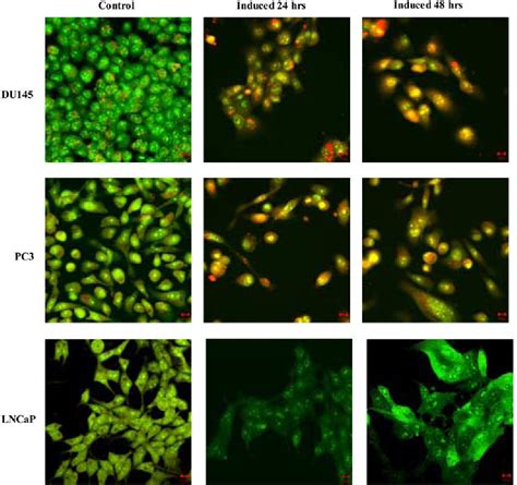 Figure From Functional Analysis Of The Host Defense Peptide Human Beta Defensin New Insight