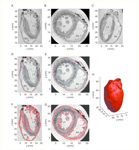 Mri Based Tissue Segmentation A C Down Sampled Mri Image In Three