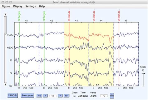 Artifact Detection In Epoched Data Ucdaviserplab Github Wiki