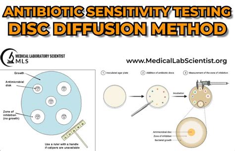 Antibiotic Sensitivity Testing Disc Diffusion Method Medical