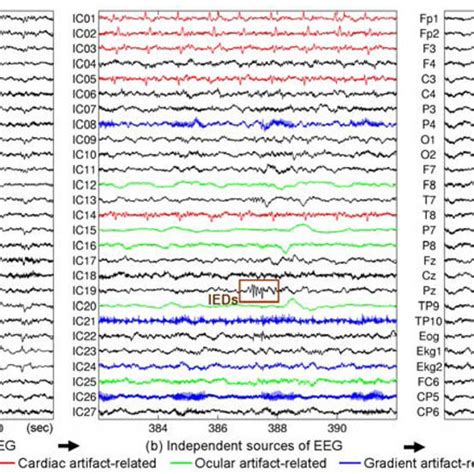 Illustrative Examples Of 10 Sec Of A Raw Eeg Data Gradient Artifact Download Scientific