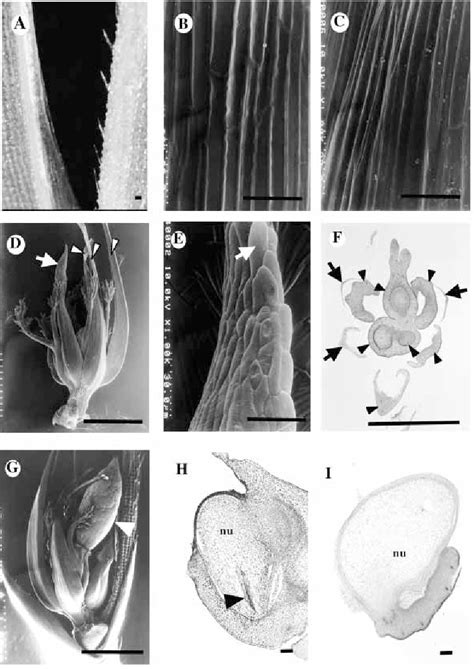 Figure 2 From Superwoman1 And Drooping Leaf Genes Control Floral Organ