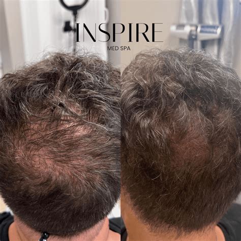 Gallery Inspire Med Spa