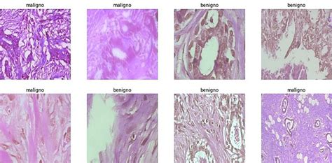 Sample Histopathology Images Obtained From The Source Download
