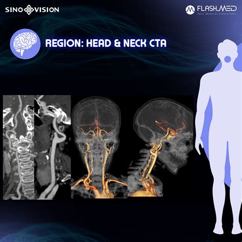 Flashmed 🔍 Explore Advanced Imaging For The Head And Neck Cta Region