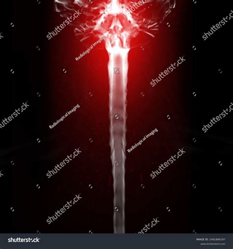 Mri Cervical Spine Myelogram Seqeunce Diagnostic Stock Illustration 2491866197 Shutterstock