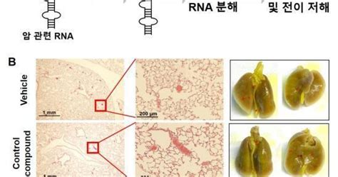 부산대 연구팀 질병 연관 Rna 분해전략 활용해 암 치료 가능성 확인