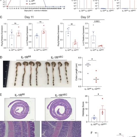 Epithelial Cellintrinsic Il 1r Signaling Dictates Intestinal