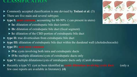 Choledochal Cystpptx