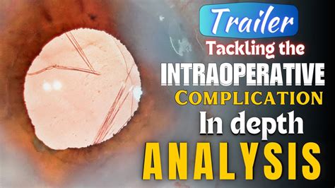Trailer Tackling The Intraoperative Complication In Depth Analysis Trailer Tackling The Intraoperative Complication In Depth Analysis