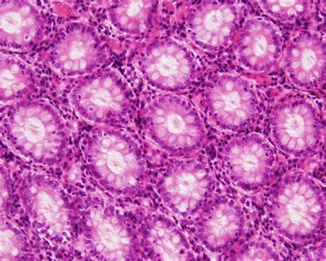 Crypts Of Lieberkühn Intestinal Gland Intestinal Crypt